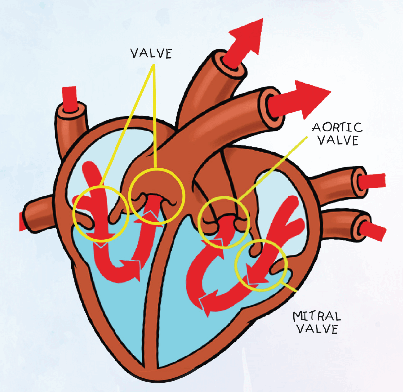 What is RHD? - Heart Heroes Fiji